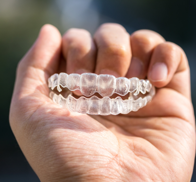 How Long Do I Need To Wear A Retainer After Invisalign? – Comfort Dental Weymouth MA, South ...