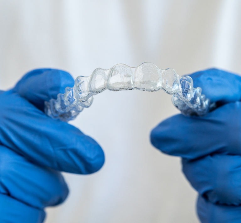 What are attachments in Invisalign treatment? – Comfort Dental Weymouth ...